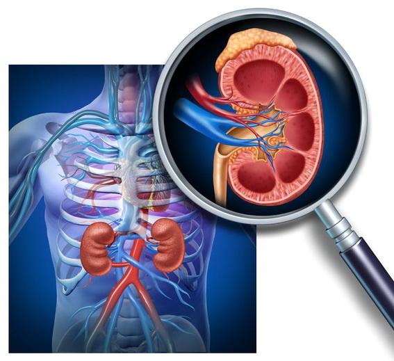 Лек: Брзо отстранување на камен и песок во бубрег | BabinLEK